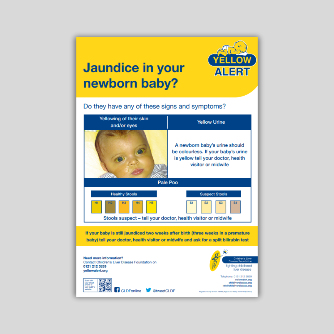 Jaundice Poster – British Liver Trust & Children's Liver Disease ...